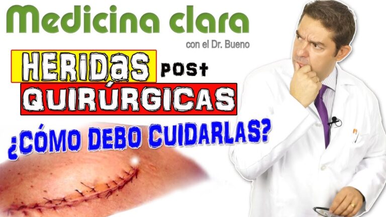 ¿Cuánto Tarda en Cicatrizar un Corte con Puntos? Todo lo que Necesitas ...
